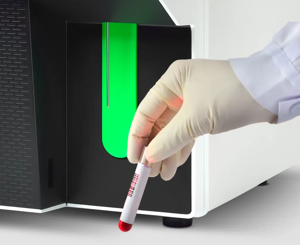 Smart 3-Part Hematology Analyzer MS-40 - SoyMed