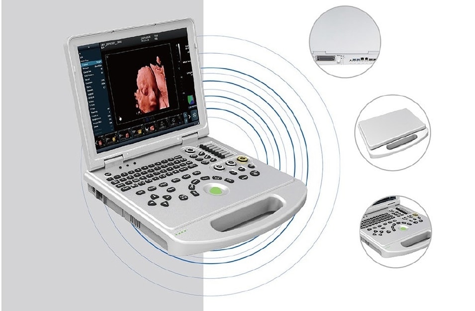 OBGYN Recommended Color Doppler Ultrasound Machine-MS-U50 - SoyMed