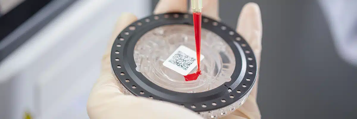 Fully Automatic Dry Chemistry Analyzer MSD-01 - SoyMed